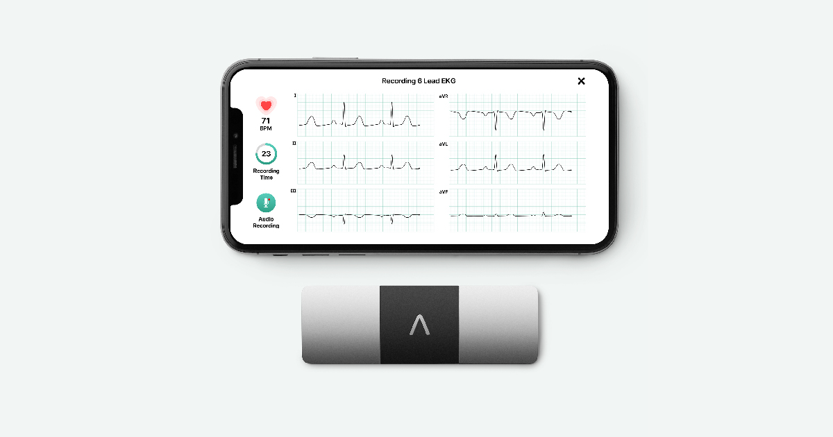 EKG Anywhere, Anytime | AliveCor